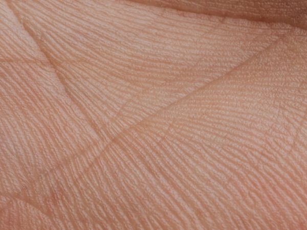 Hautschichten Mensch – Die Haut verstehen | dermolex